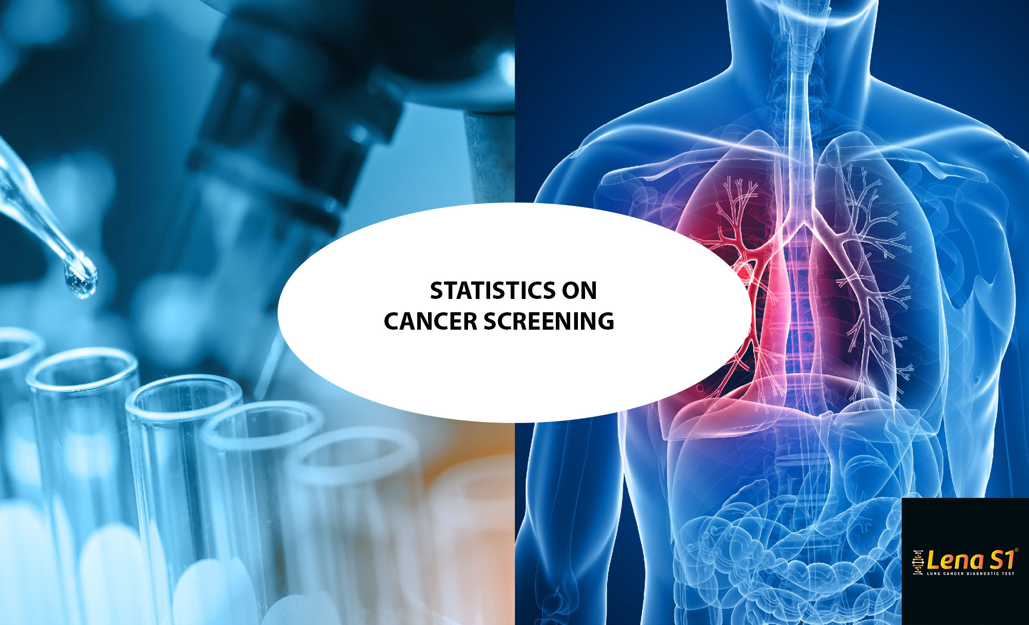 Lung Cancer – Lena Diagnostics
